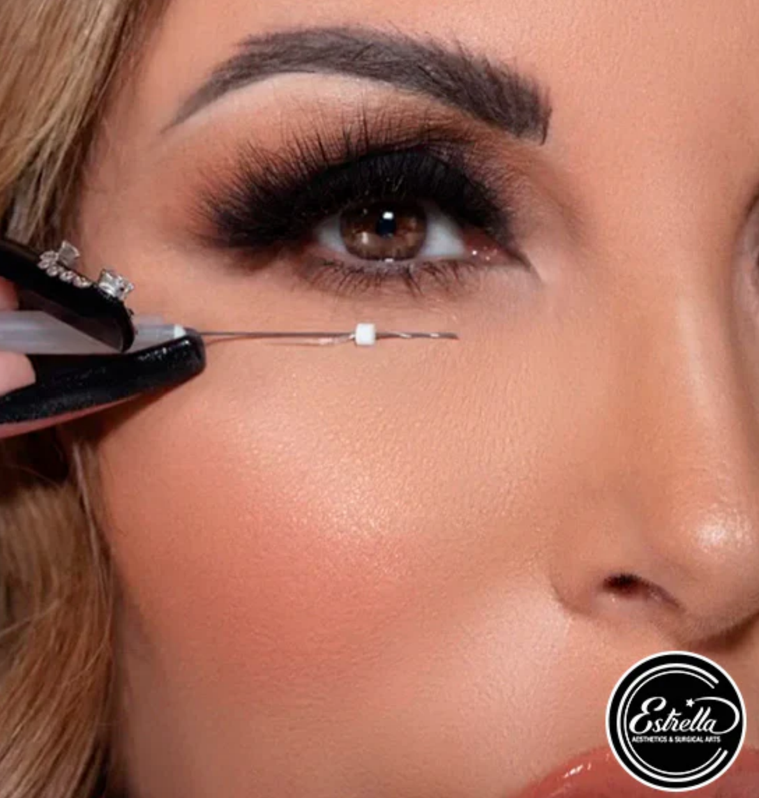 Brighten Your Look This Fall Season with Under-Eye Threads + FREE PRP ...