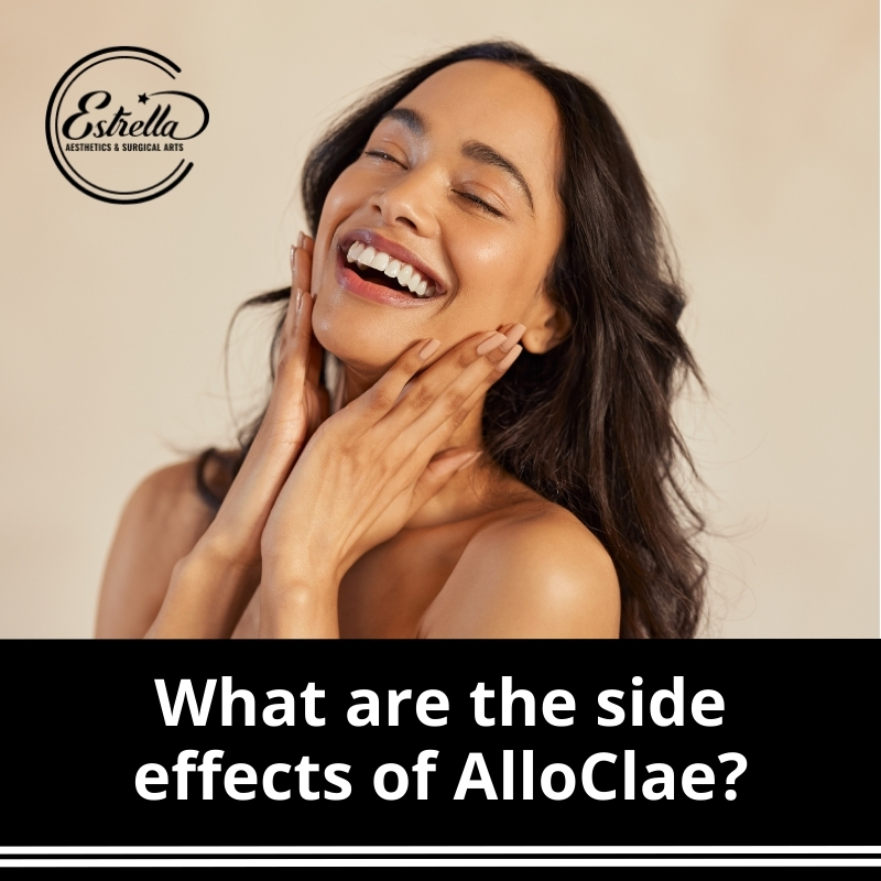 Is AlloClae considered a temporary or permanent filler? - Estrella ...